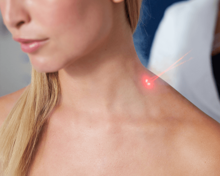 CRYOFACIAL και CRYOTOPICAL - Soma Wellness and more